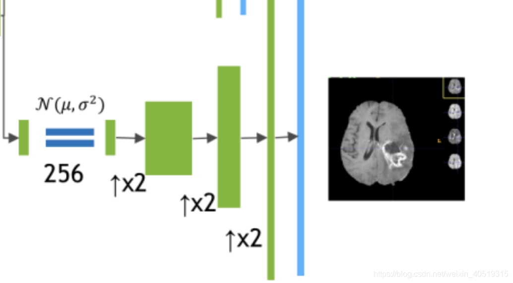 [论文解读]Brats18 NO.1:3D MRI brain tumor segmentation using autoencoder ...