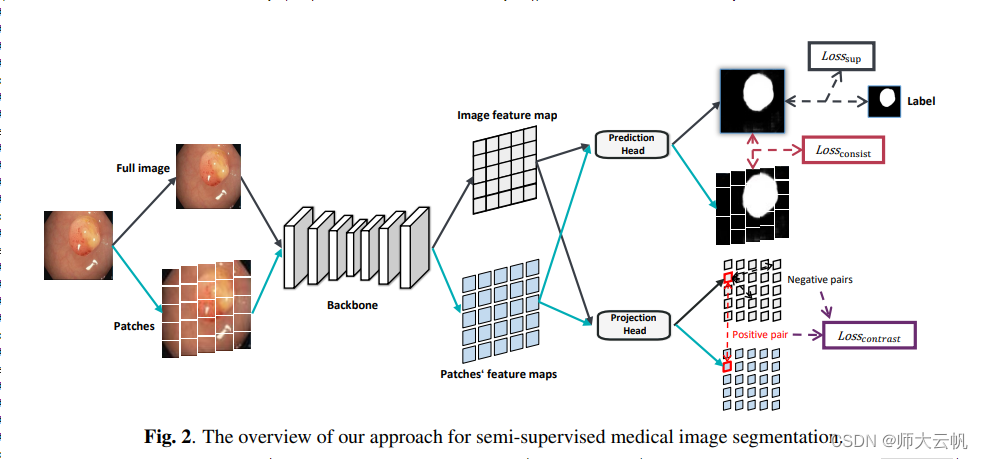 contrastive learning medical image segmentation_dual contrastive learning with anatomical ...
