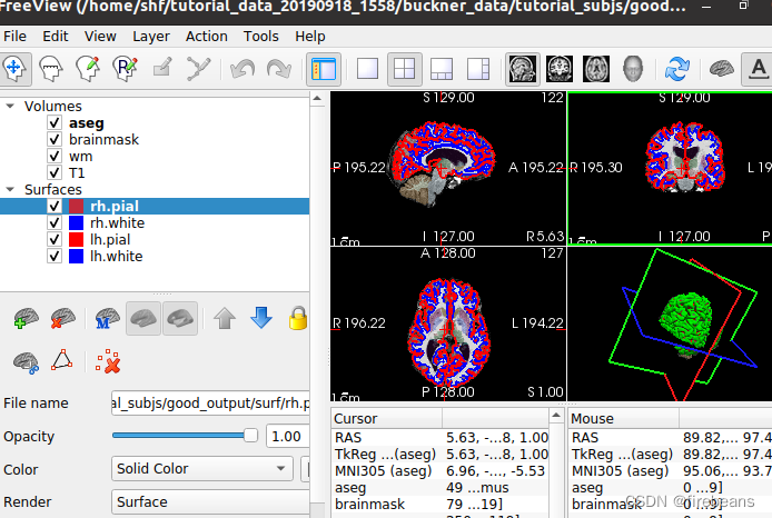 FreeSurfer入门(1) Output Data-CSDN博客