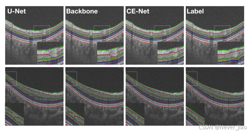 CE-Net: Context Encoder Network for 2D Medical Image Segmentation_gu 等人于2019年提出一种上下文编码网络ce-net ...