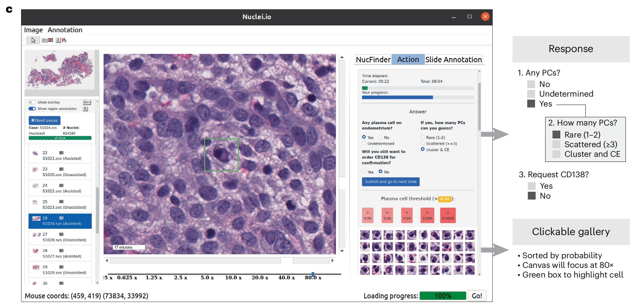 人工智能在病理组学和影像组学中的最新研究进展|顶刊速递·24-06-28_nuclei.io-CSDN博客