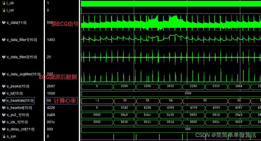 基于fpga的ecg信号滤波与心率计算verilog实现包含testbench基于fpga的心率检测系统 Csdn博客