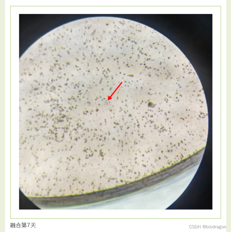 博奥龙HT/HAT选择性培养基，您的信任之选_ht培养基博奥龙-CSDN博客