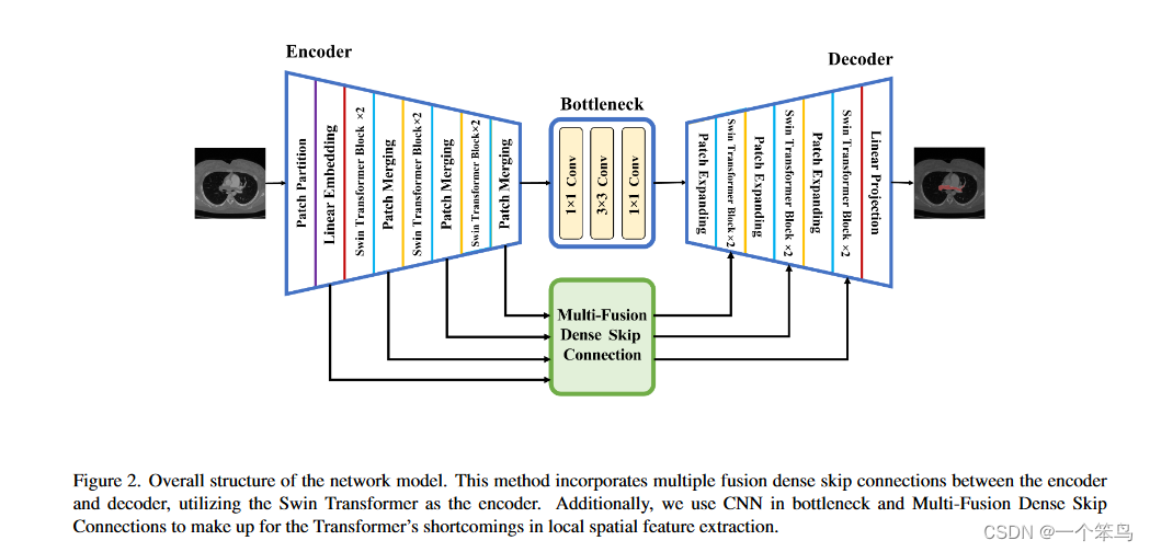 scunet++:基于多融合密集跳跃连接的Swin-UNet和CNN瓶颈混合架构的肺栓塞CT图像分割_肺栓塞分割-CSDN博客