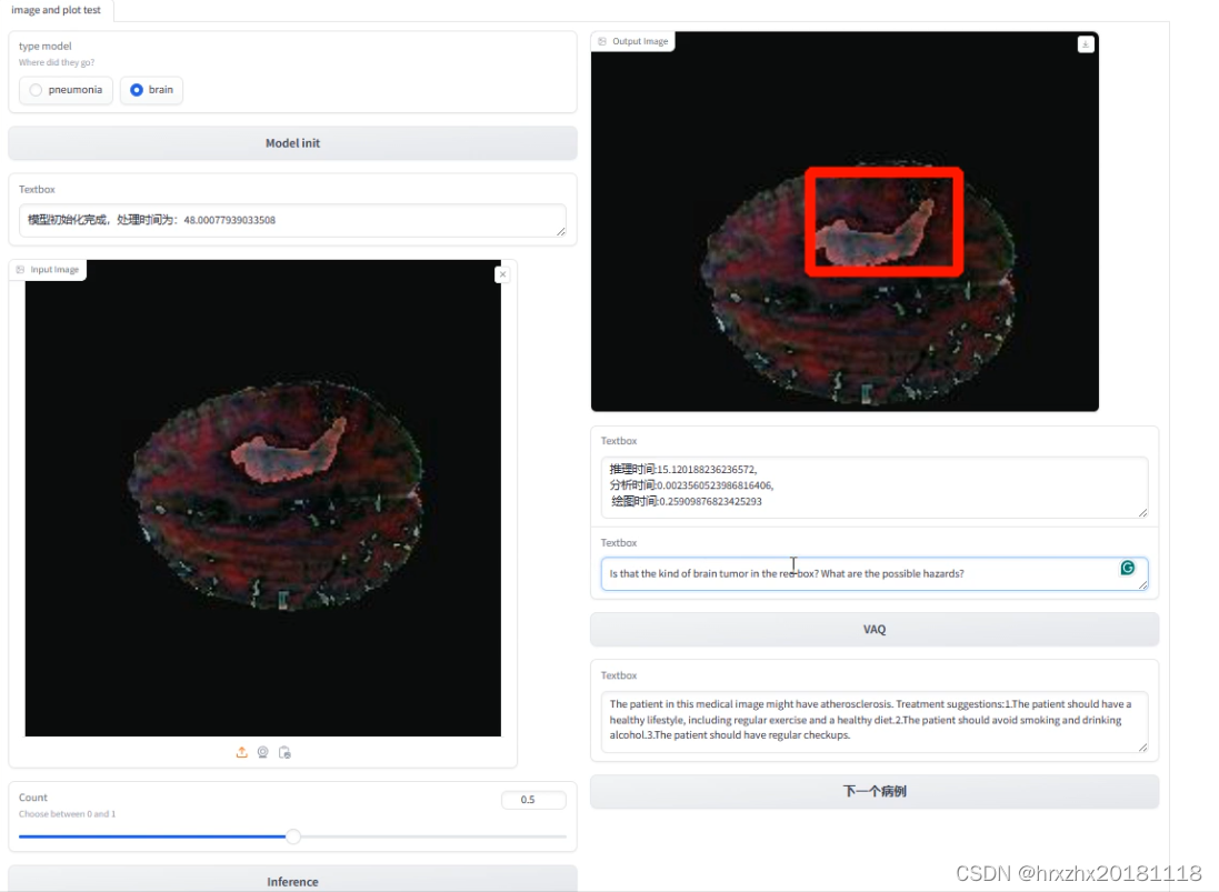 MMdetection框架下简单实现界面可视化+大模型实现本地问诊_mmdetection gradio-CSDN博客