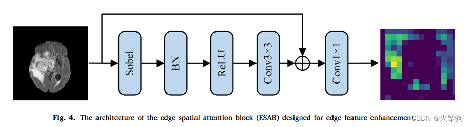 Brain tumor segmentation based on the fusion of deep semantics and edge information in ...