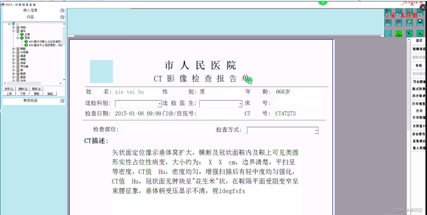 C语言+ MSSQL技术开发的 PACS系统源码：CT后处理技术之仿真内镜CTVE_内镜软件源代码-CSDN博客