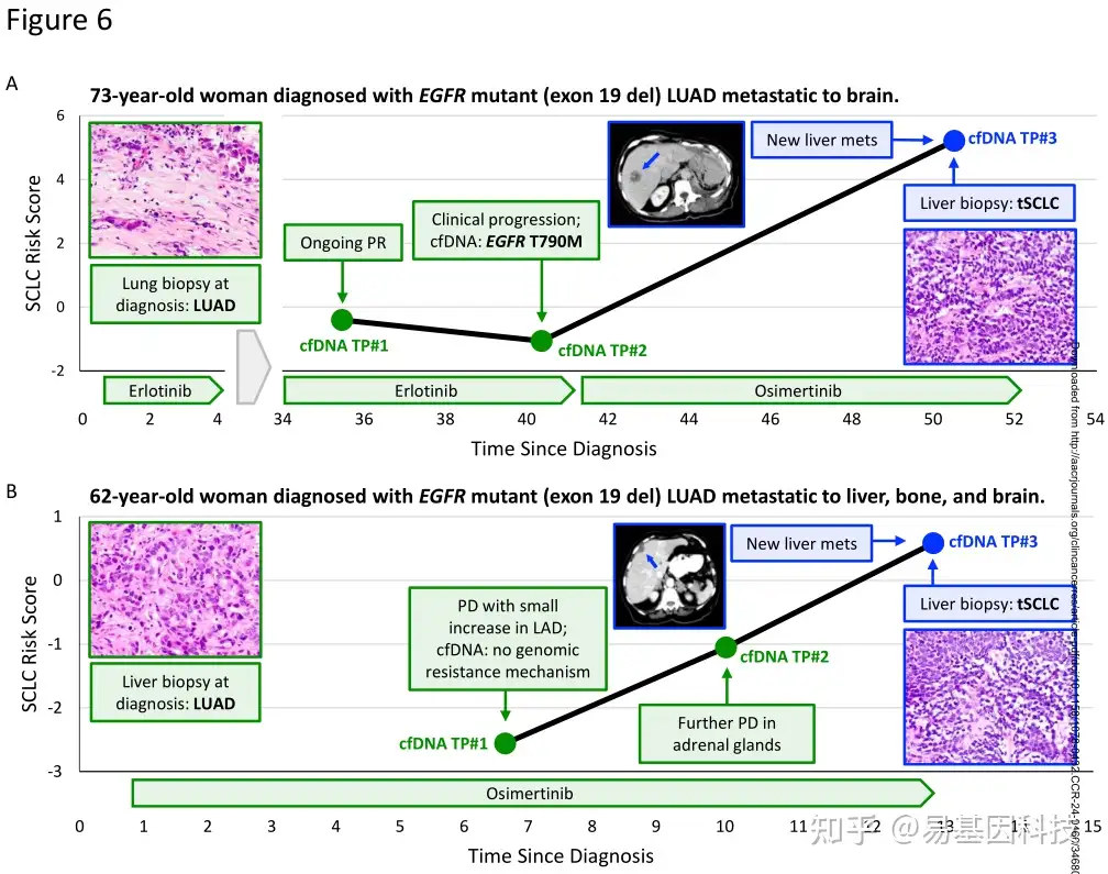 易基因：表观基因组cfDNA分析检测晚期EGFR突变肺腺癌患者的小细胞转化 | 肿瘤监测研究_cfdnachip-CSDN博客