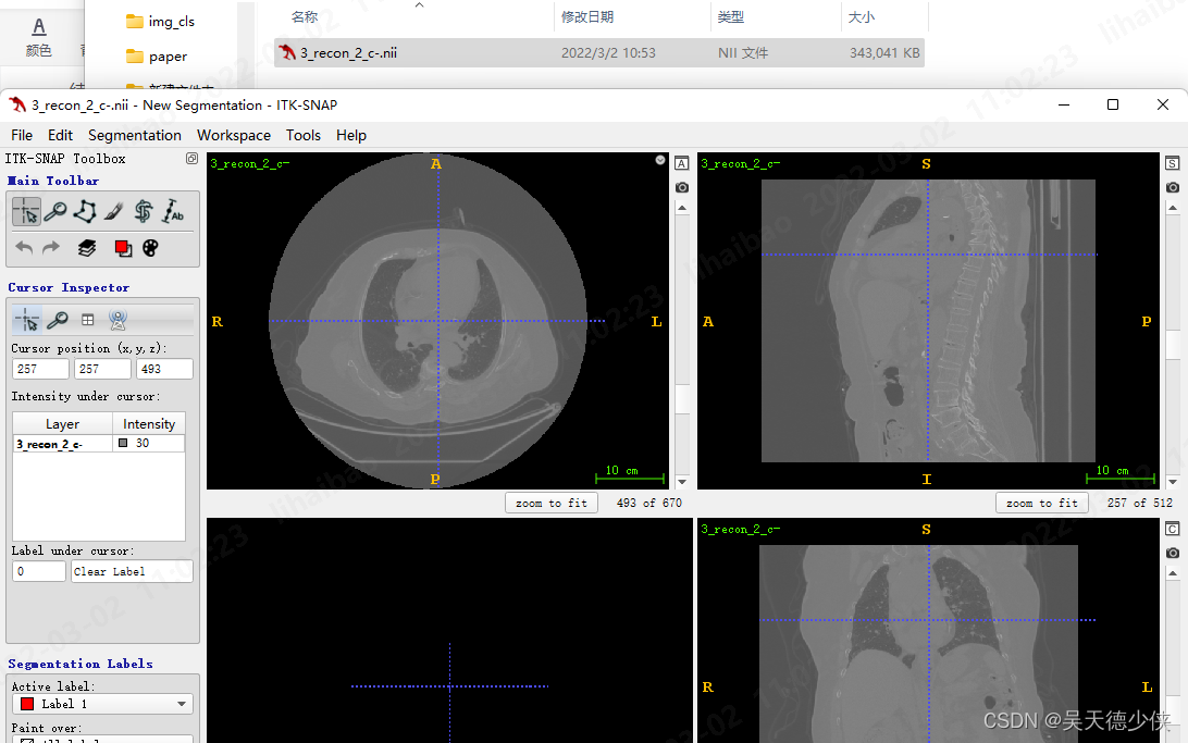 使用python进行dicom序列转nii_dicom2nifti-CSDN博客