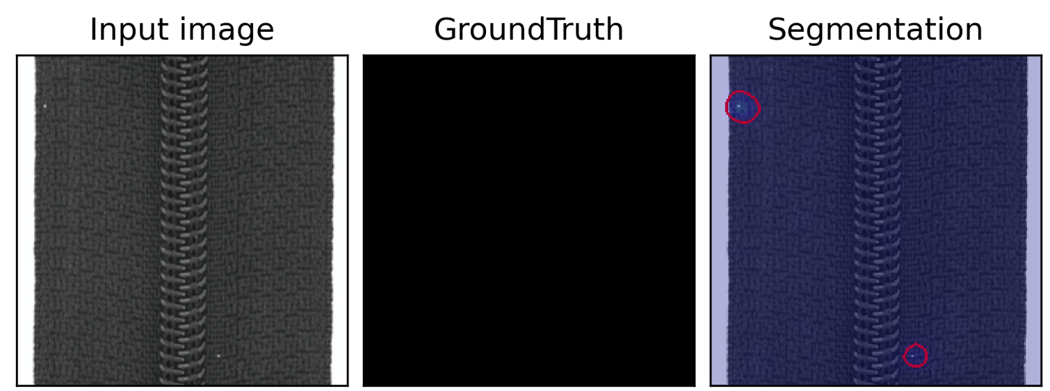 【阅读笔记】《Student-Teacher Feature Pyramid Matching for Anomaly Detection》-CSDN博客