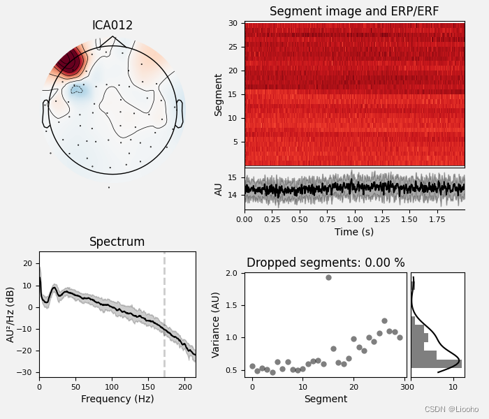 MNE-Python | 使用 ICLabel 模型进行 ICA 并自动修复样本-CSDN博客