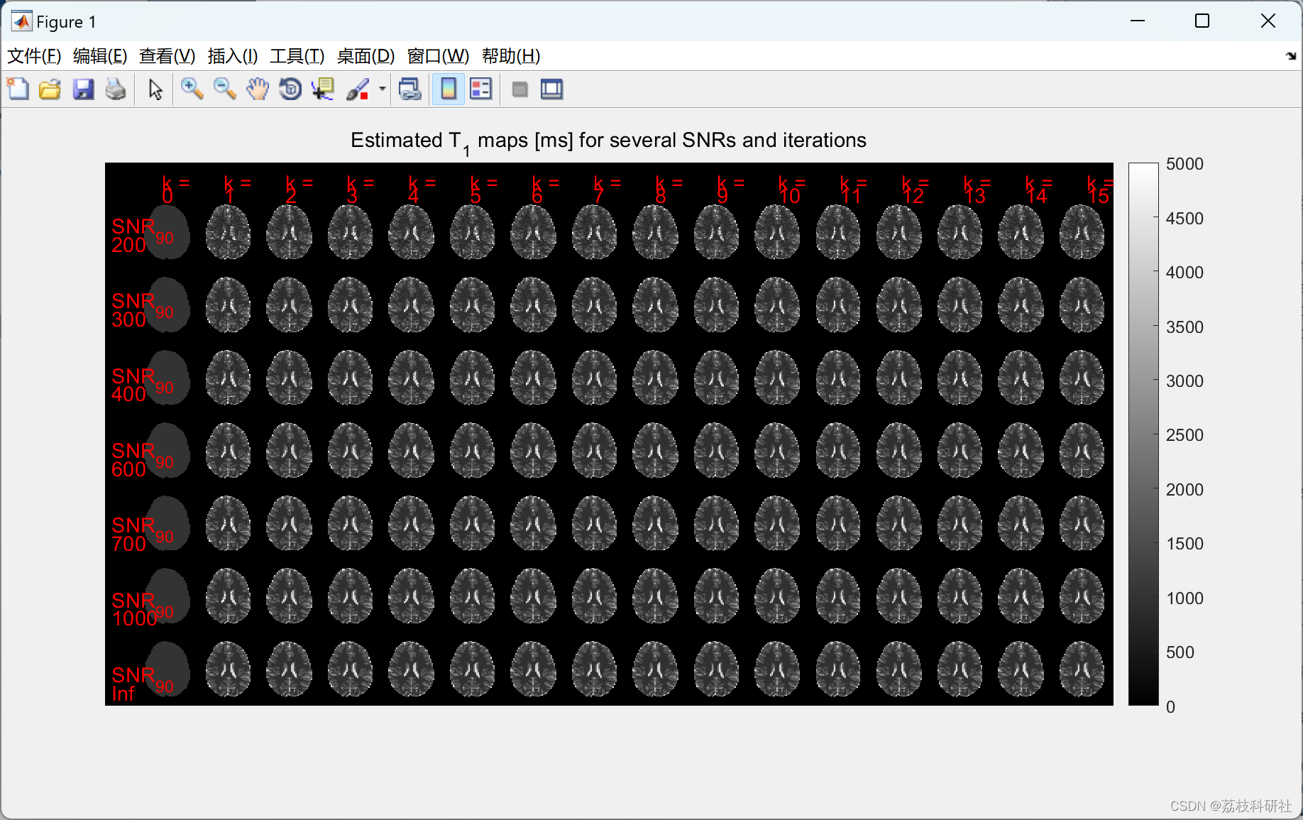 【核磁共振】用于准确和精确的VFA MRI的快速算法研究（Matlab代码实现）_核磁matlab-CSDN博客