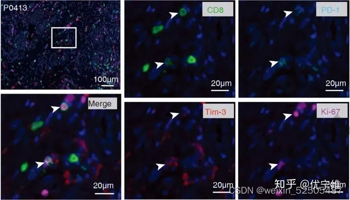 多重荧光免疫组化（mIHC）实验原理-CSDN博客