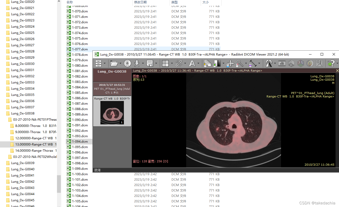 玩转肺癌目标检测数据集Lung-PET-CT-Dx ——②预览数据集，绘制锚框-CSDN博客