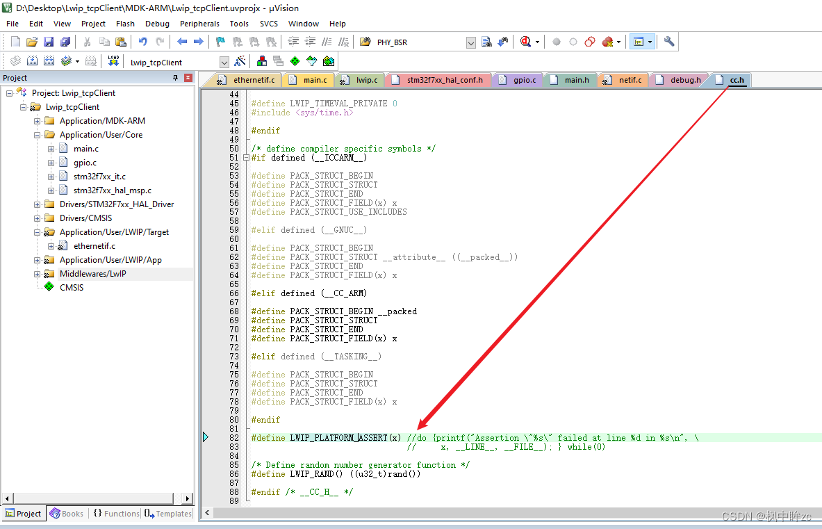 STM32F767+LWIP+CubeMX配置_stm32f767 lwip-CSDN博客