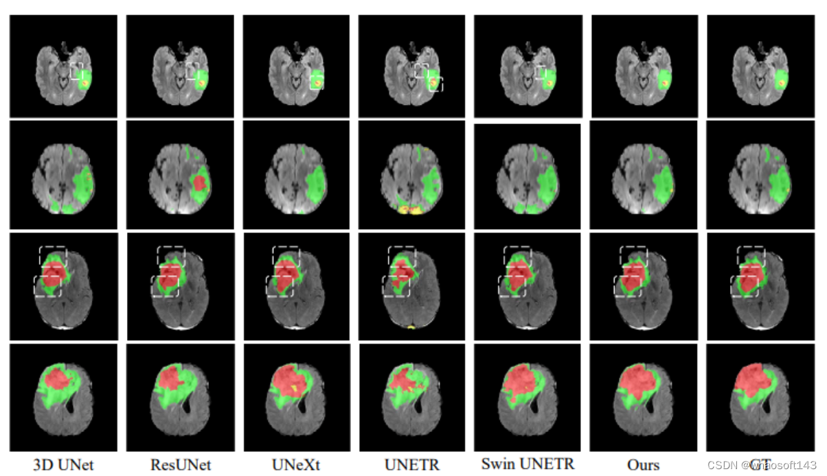 SPM~~_全局形状先验信息-CSDN博客