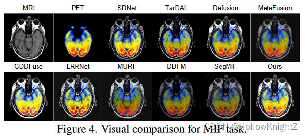 论文阅读笔记：Equivariant Multi-Modality Image Fusion-CSDN博客