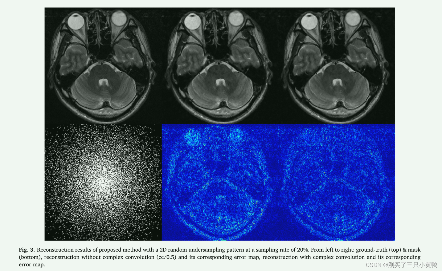 DeepcomplexMRI: Exploiting deep residual network for fast parallel MR imaging with complex ...