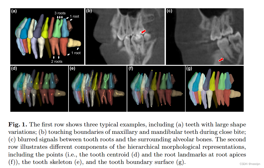 Hierarchical Morphology-Guided Tooth Instance Segmentation from CBCT Images-CSDN博客