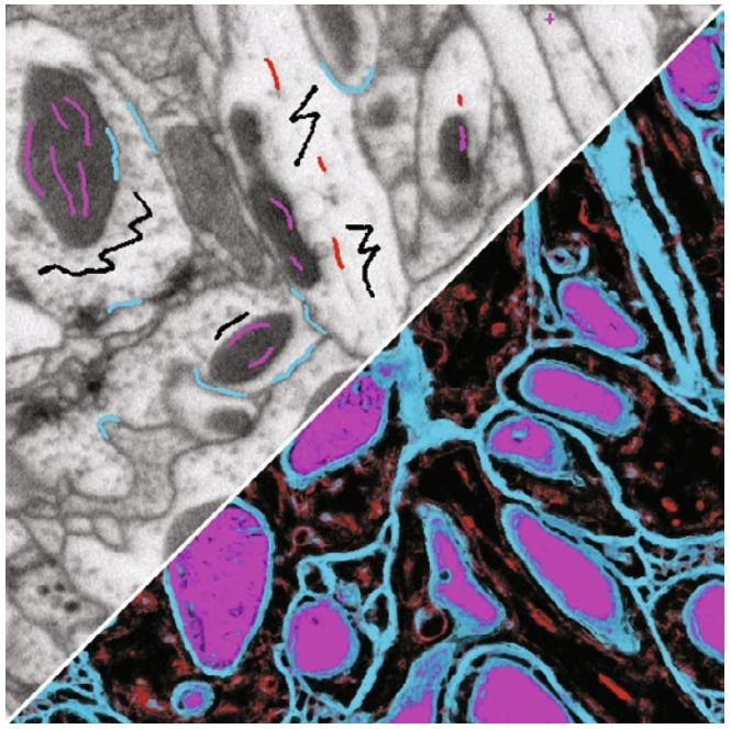 Nat. Methods | ilastik:为生物图像分析而生的交互式机器学习平台-CSDN博客