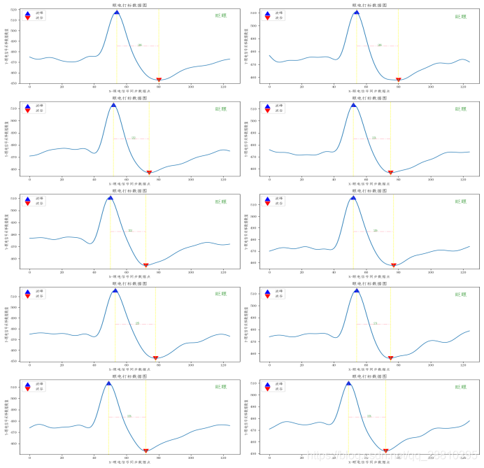EOG眼电信号（眨眼检测）-CSDN博客