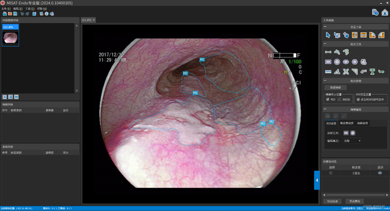MISAT医学图像分割与标注软件套装专业版正式上线-CSDN博客