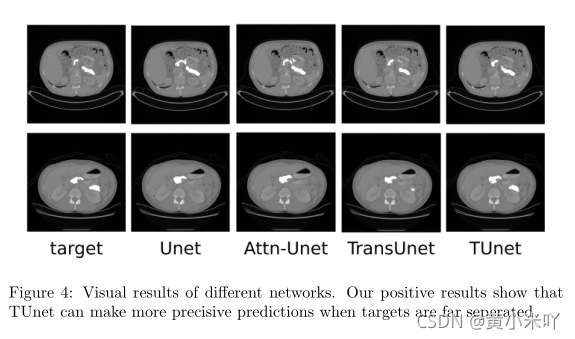 [Transformer]Transformer-Unet: Raw Image Processing with Unet_unet transformer-CSDN博客