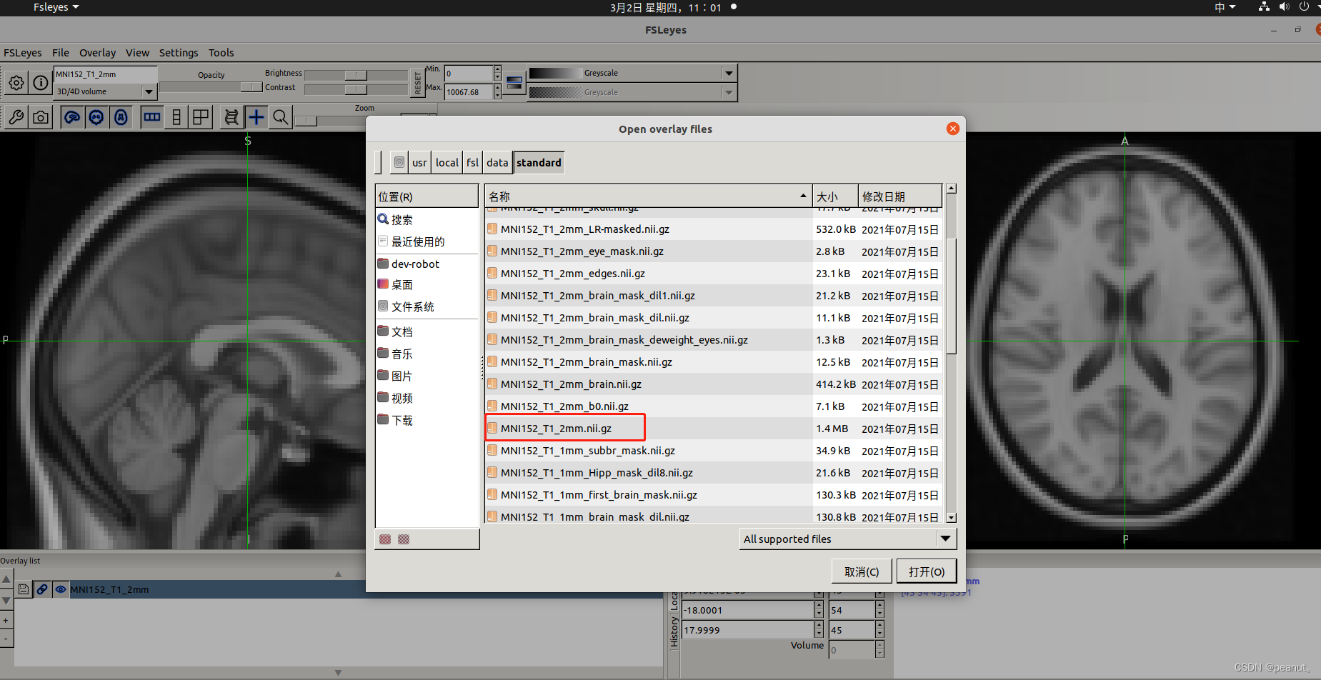 【Medical Image】MRI结构像自定义脑部ROI-基于FSL_mrview mrtrix 绘制roi-CSDN博客