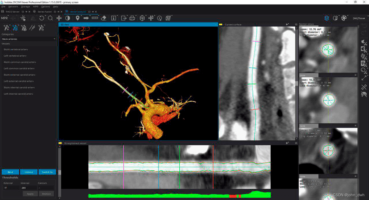 Inobitec DICOM Viewer Pro 2.8.0 Crack_inobitec教程-CSDN博客