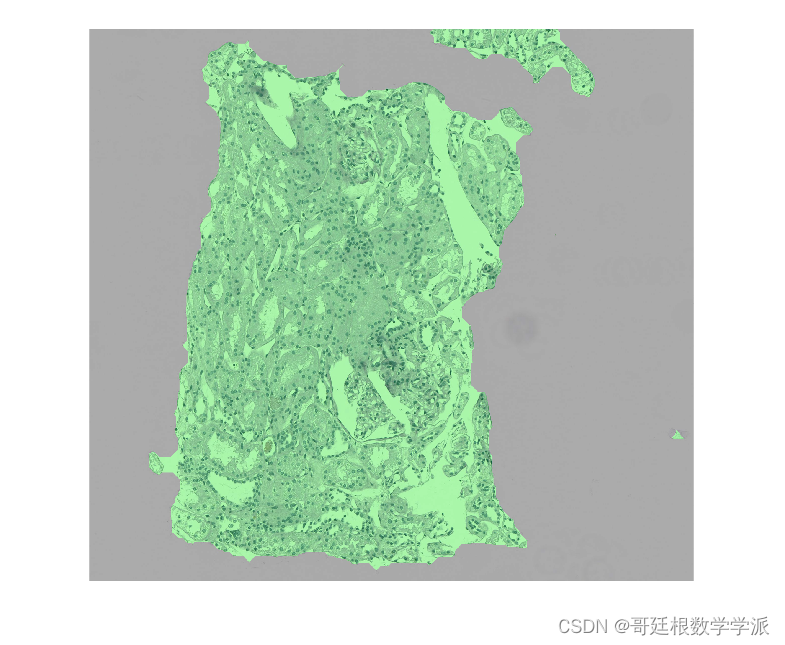 MATLAB环境下基于图像处理的计算病理学图像分割（MATLAB R2021B）_matlab_哥廷根数学学派-魔乐社区