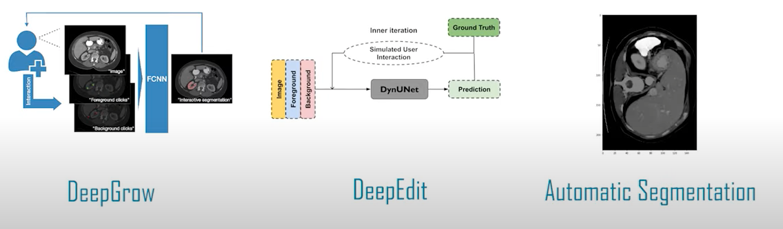 MONAI Label中Deep Grow、Deep Edit用法-CSDN博客