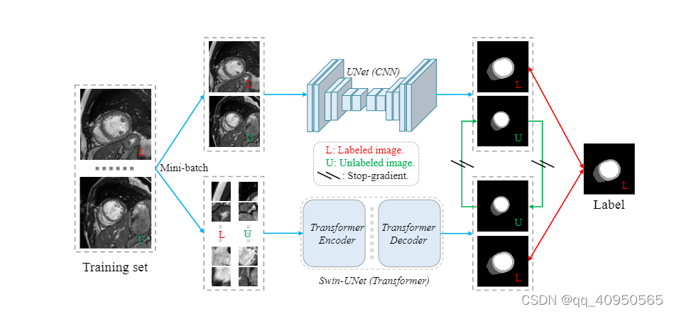 半监督分割与Transformer结合论文阅读（更新中）_semi-supervised medical image segmentation via cro-CSDN博客