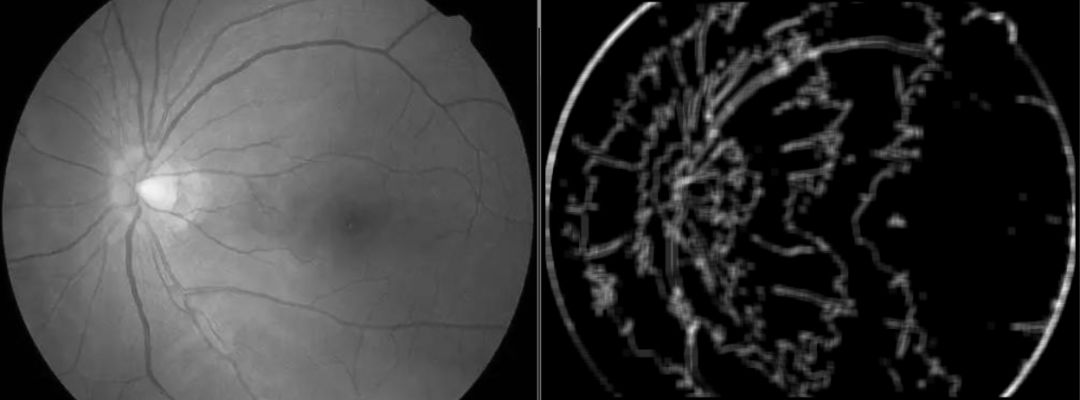 基于灰度共生矩阵(GLCM)的图像纹理分析与提取-CSDN博客