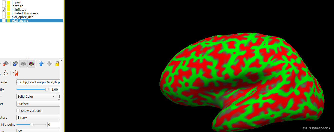 FreeSurfer入门(1) Output Data-CSDN博客