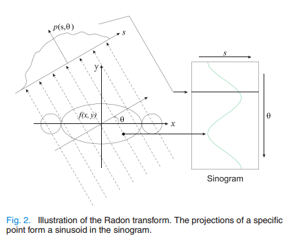 Radon Inversion via Deep Learning_iradonmap-CSDN博客