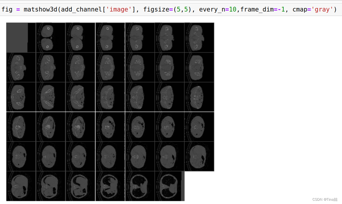 函数解析--monai.transforms.RandAxisFlipd-CSDN博客