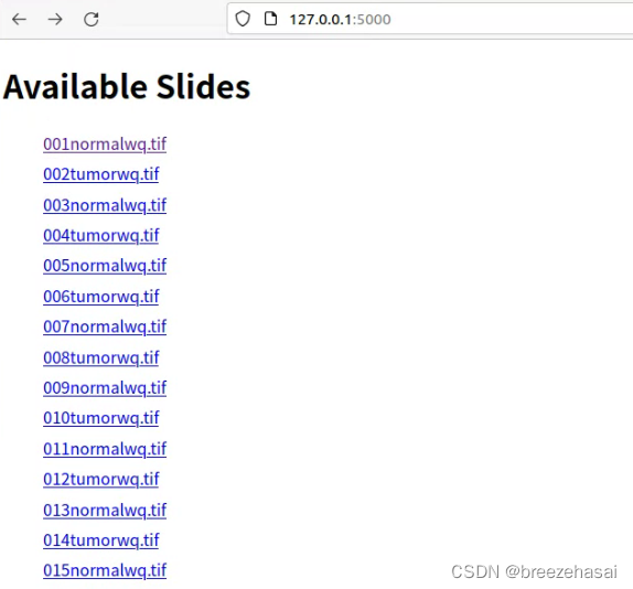 WSI图像缩略展示：Flask与openslide实战教程-CSDN博客