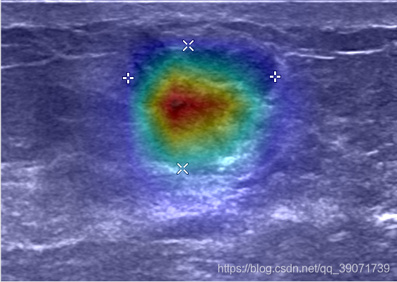 【卷积神经网络可视化】之热度图可视化_visualizing heatmaps of class activation in an ima-CSDN博客