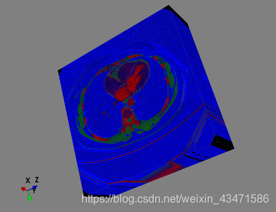 Python SimpleITK+mayavi实现医学图像的三维重建_医学图像 3d 渲染-CSDN博客