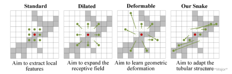 蛇形卷积(Snake Convolution)---DSCNet-CSDN博客