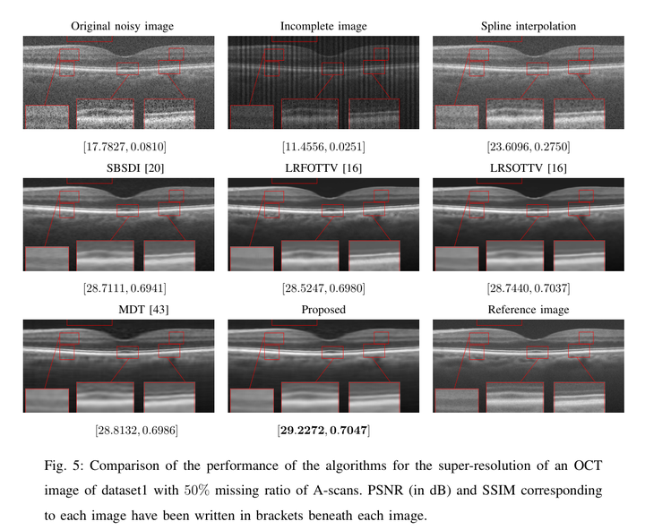 OCT超分辨率：Optical Coherence Tomography Image Enhancement via Block Hankelization and Low Rank ...