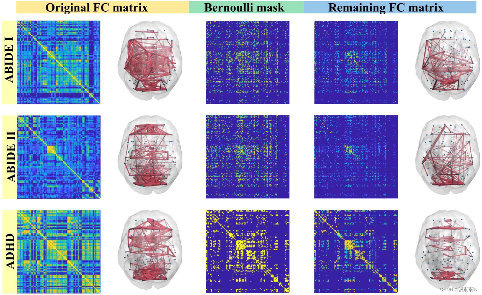 [论文精读]A-GCL: Adversarial graph contrastive learning for fMRI analysis ...