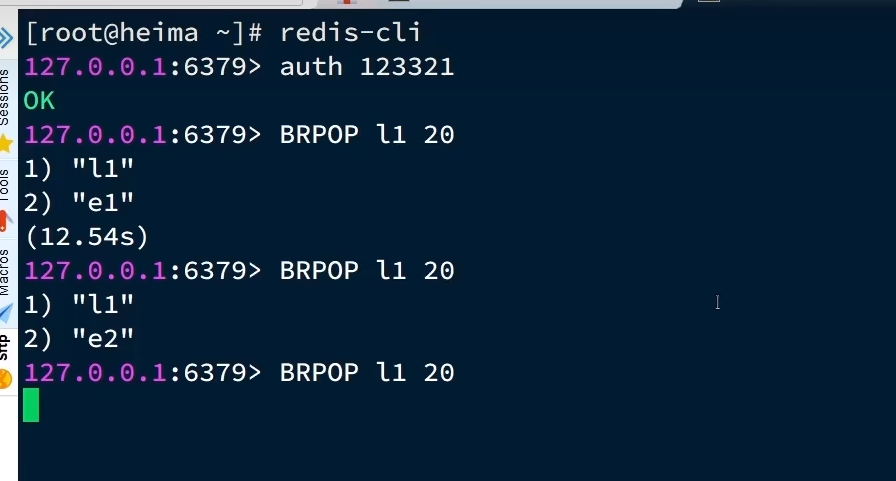 Redis——某马点评day03——part2：秒杀业务异步优化_redis.call xadd-CSDN博客
