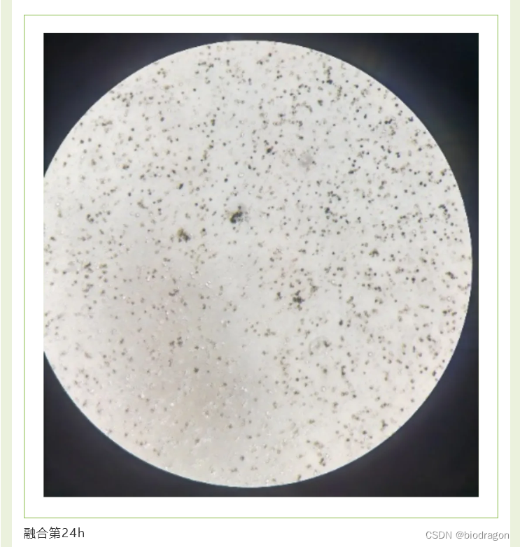 博奥龙HT/HAT选择性培养基，您的信任之选_ht培养基博奥龙-CSDN博客