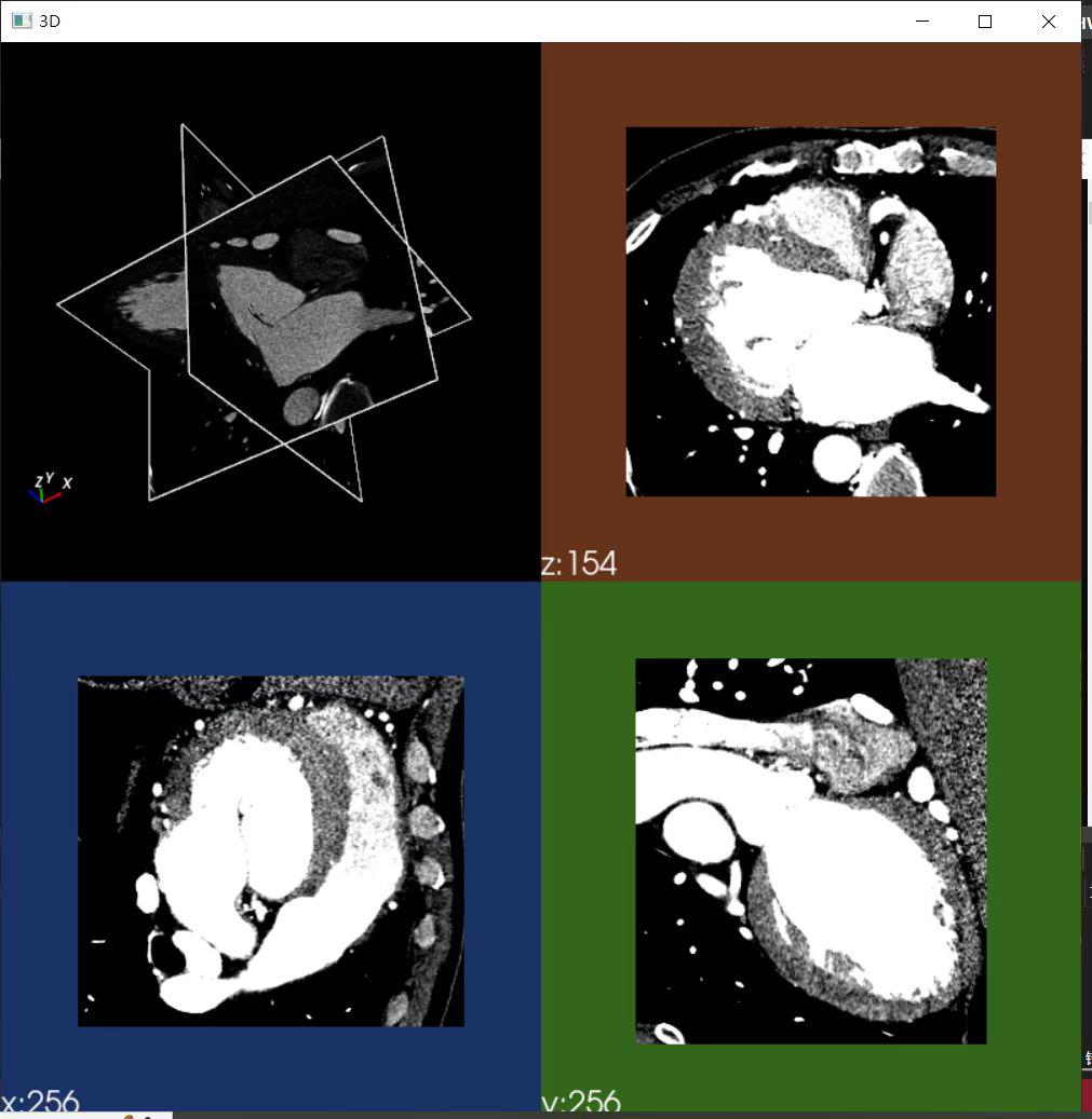 练习：VTK 四视图显示（三视图+三正交切片）_vtkimageplanewidget 四视图-CSDN博客