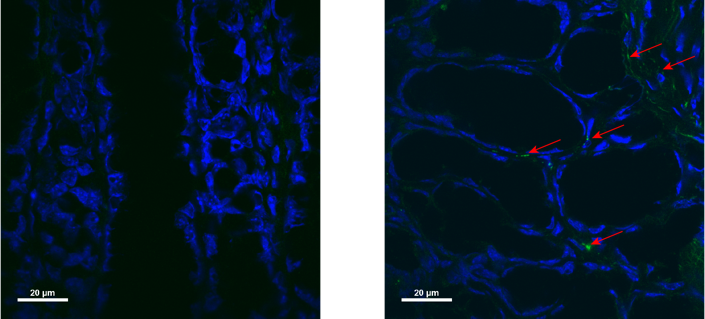 MPB：EGFP荧光标记大肠杆菌的构建-CSDN博客