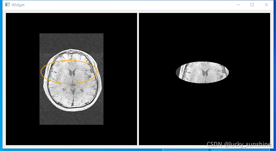 VTK 椭圆圈取ROI区域_vtkellipsearcsource-CSDN博客