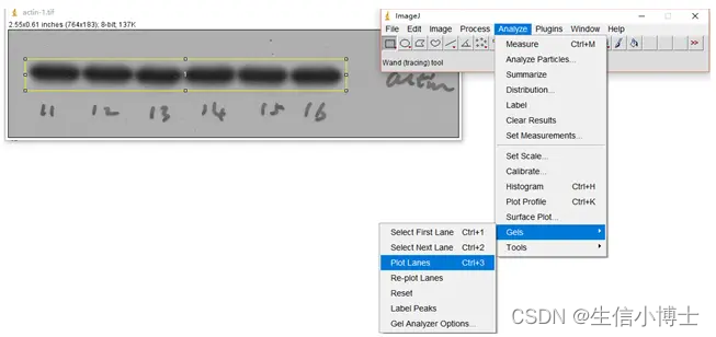 image J 对Western blot 条带进行灰度分析 量化分析_imagej分析wb条带-CSDN博客
