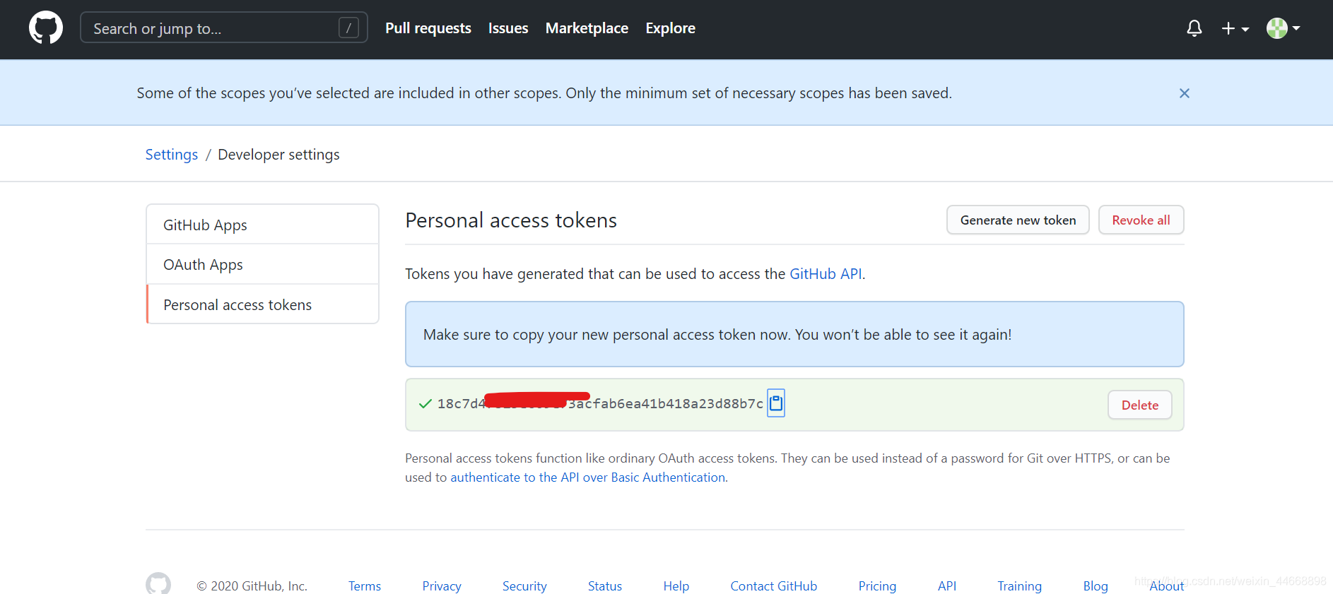 IDEA添加Github账号报错 Incorrect credentials.Request response: 401 Unauthorized_idea gitlab message ...