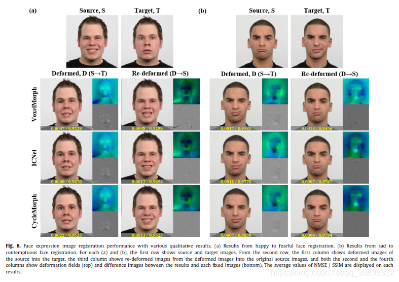 Deep Learning Based Registration文章阅读(七)《CycleMorph: Cycle consistent unsupervised deformable ...